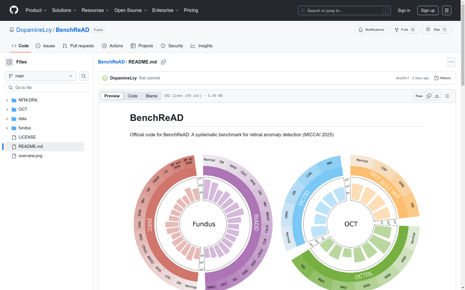 香港理工大学 发布 BenchReAD 数据集, 应用在 视网膜异常检测、医学影像 领域