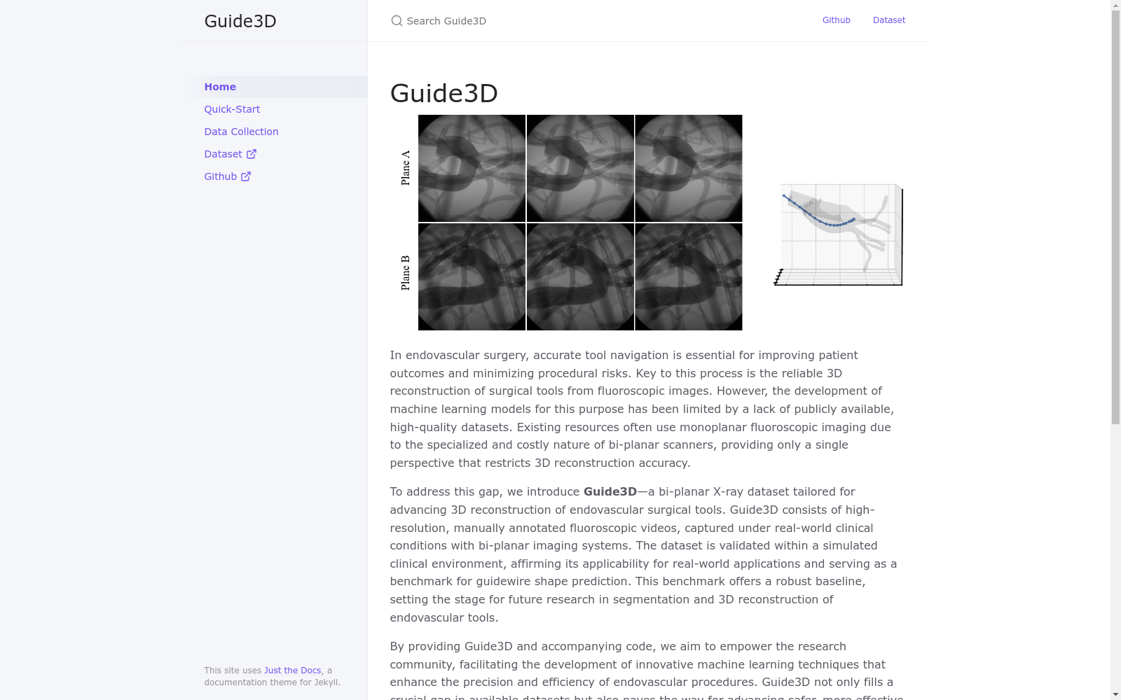 Guide3D|内窥镜手术数据集|3D重建数据集