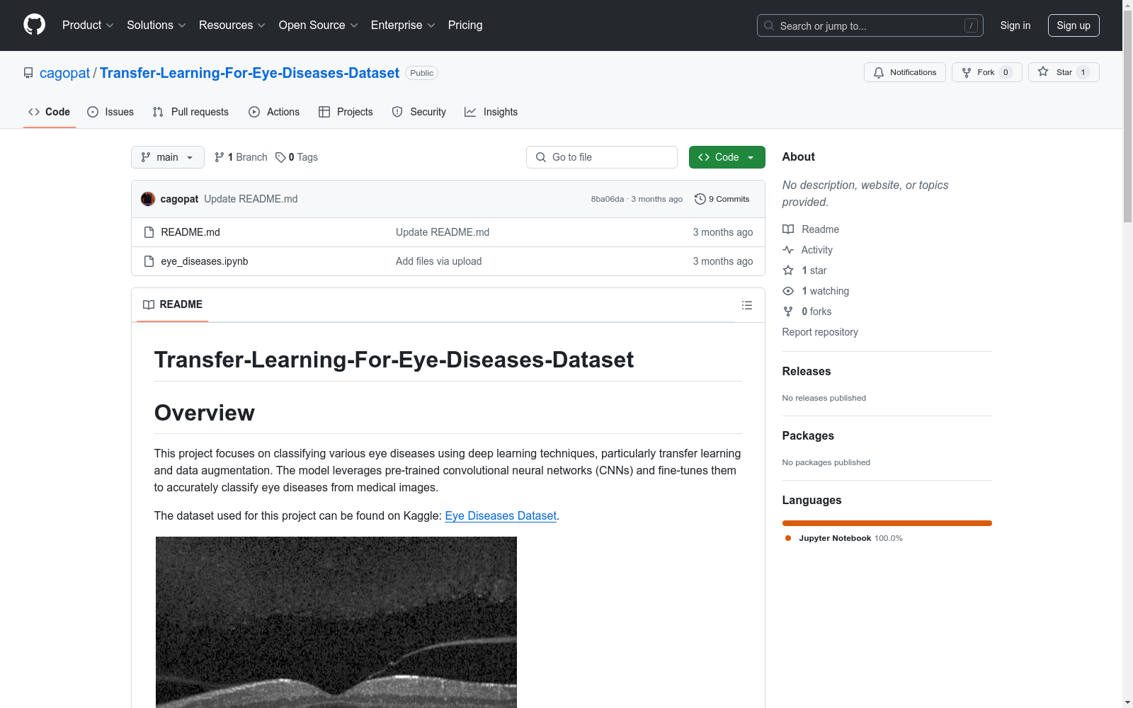 Eye Diseases Dataset|眼疾病数据集|深度学习数据集