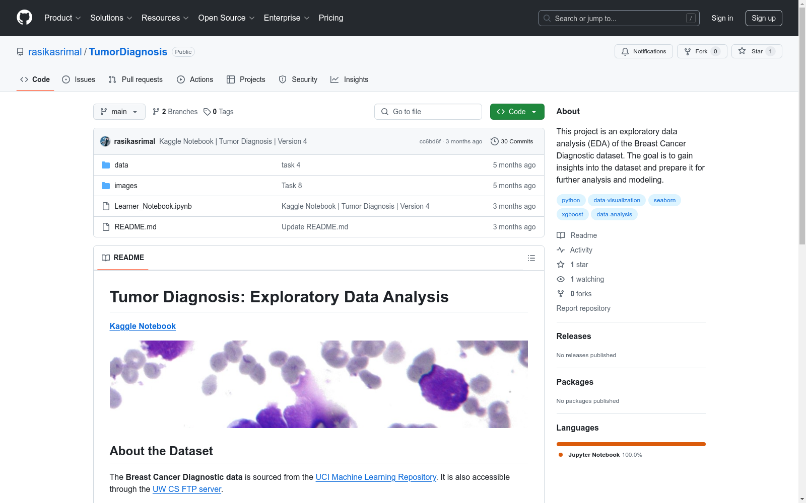 Breast Cancer Diagnostic dataset|乳腺癌诊断数据集|机器学习数据集