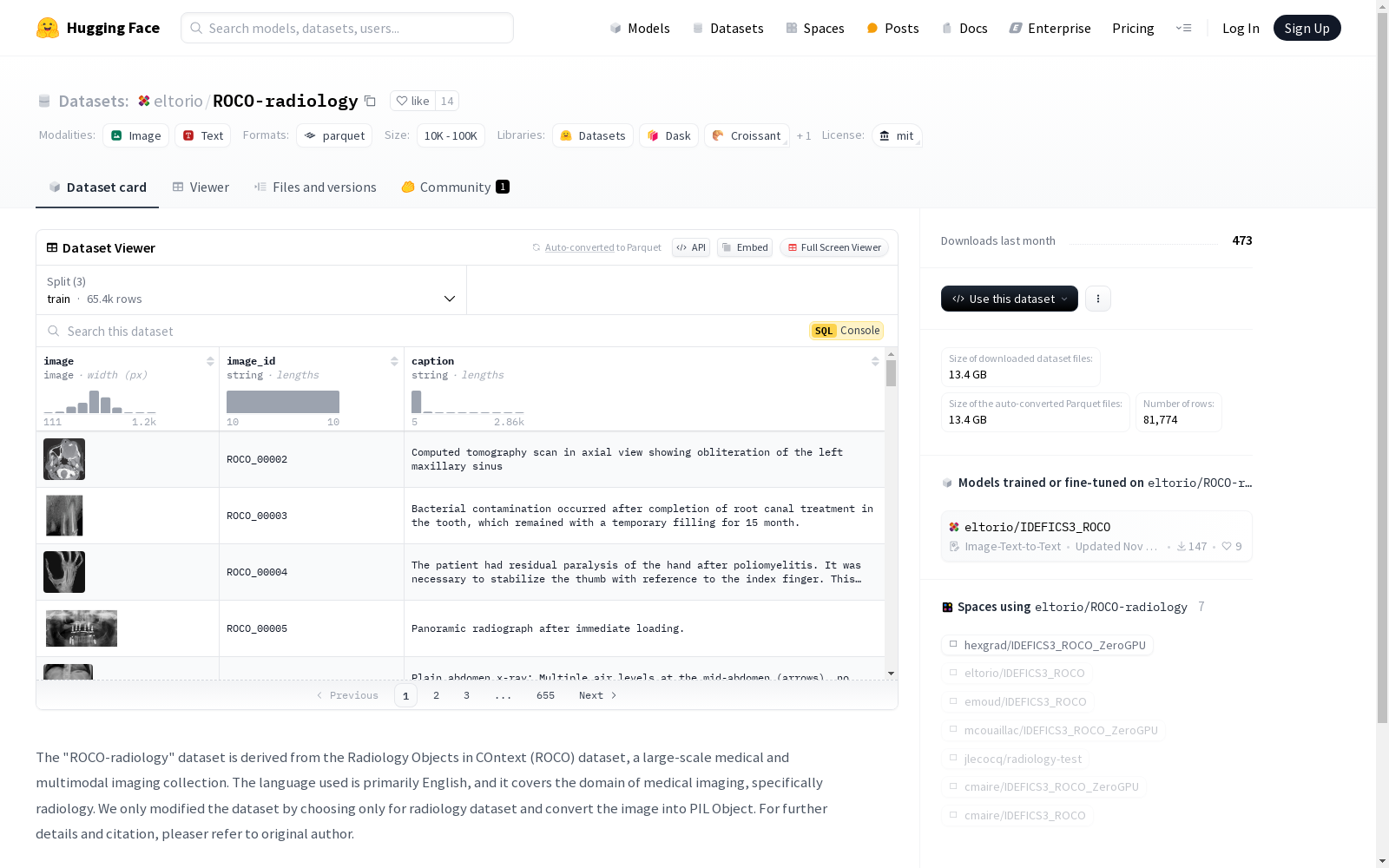 ROCO-radiology|医学影像数据集|放射学数据集