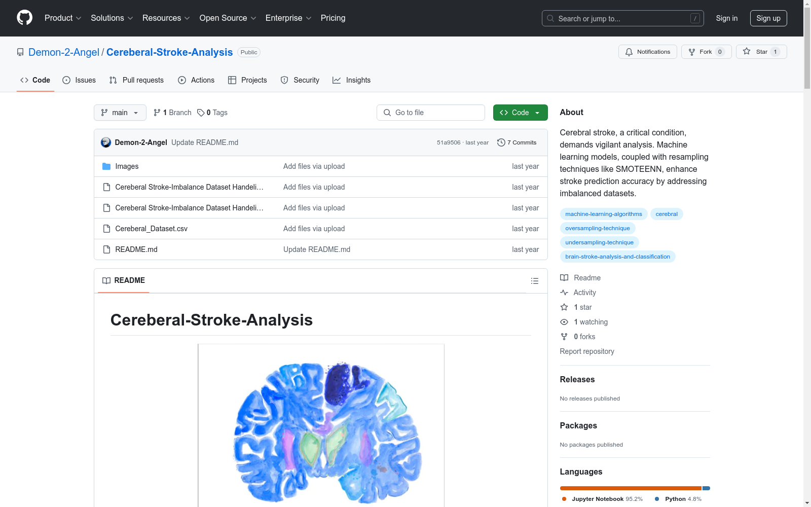 Cereberal-Stroke-Analysis|脑卒中数据集|机器学习数据集