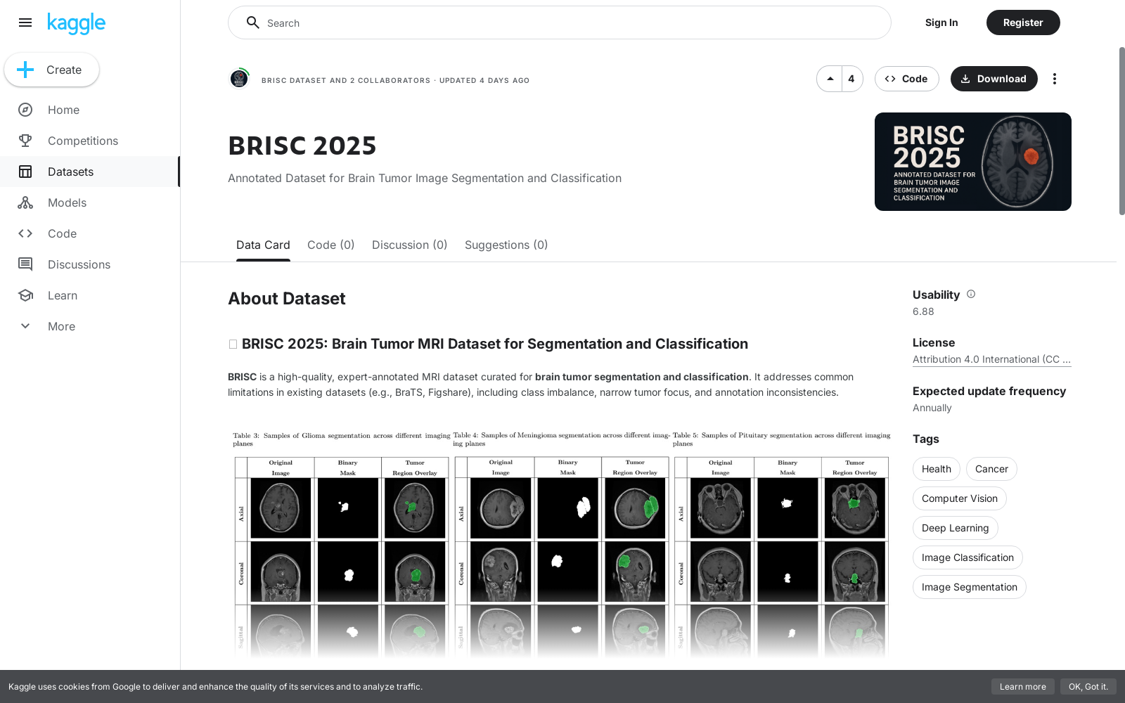 BRISC|医学影像分析数据集|脑肿瘤分割数据集